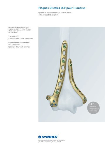 Système DHS/DCS. Incluant LCP DHS et lame DHS. - Synthes