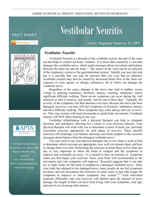 Vestibular Neuritis - Neurology Section