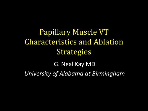 Kay-Papillary-Muscle-VT
