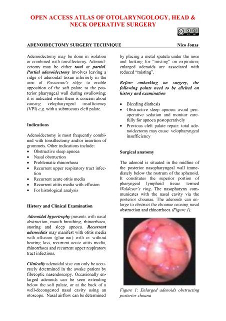 Adenoidectomy Procedure