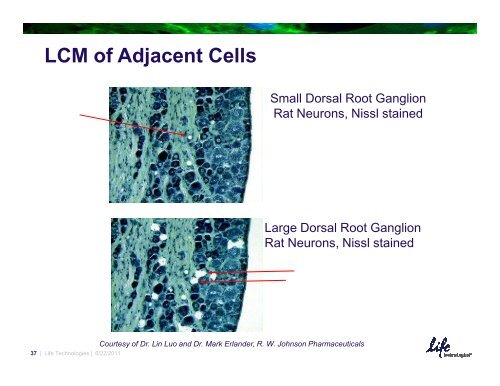 LCM of Single Cells Human