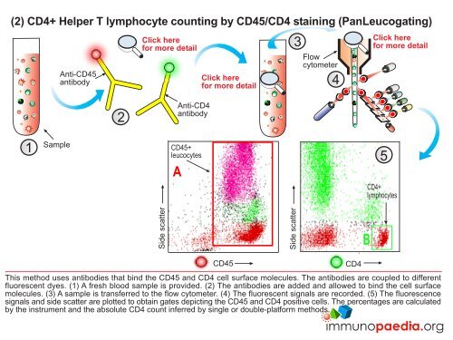 CD4+ Helper T lymphocyte counting by CD45/CD4 ... - Immunopaedia