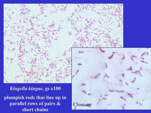 Kingella kingae, gs x100p