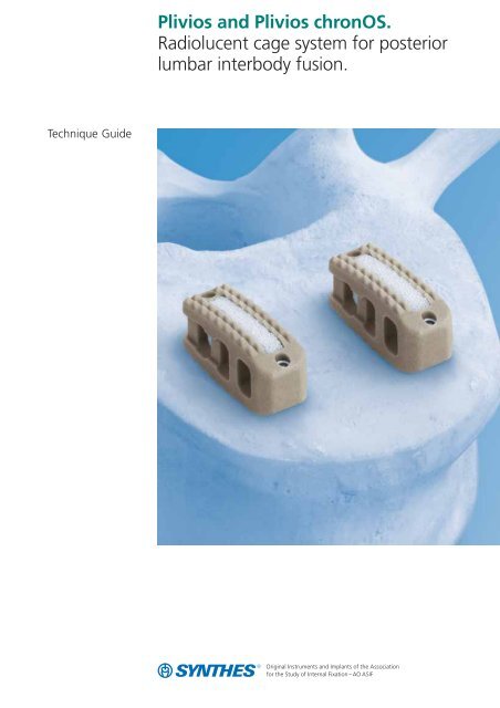 Plivios and Plivios chronOS. Radiolucent cage system for ... - Synthes