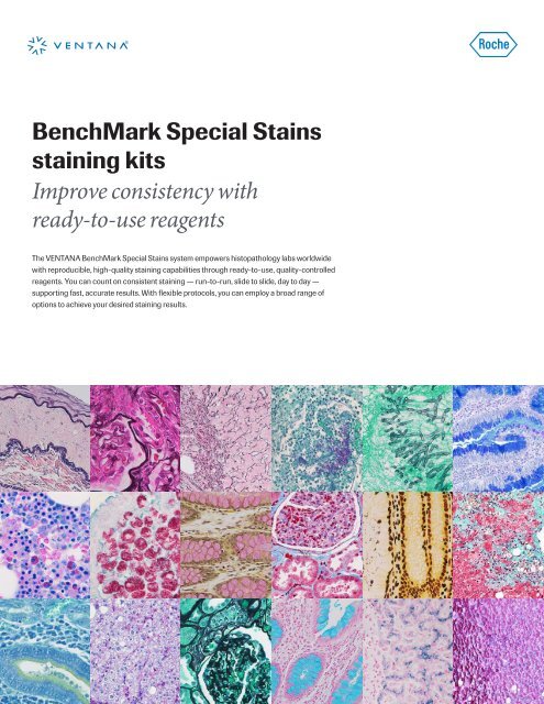BenchMark Special Stains â staining kits brochure - Ventana ...