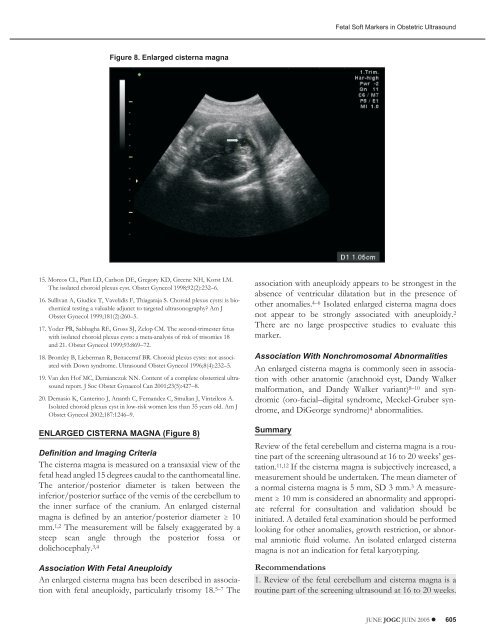 Fetal