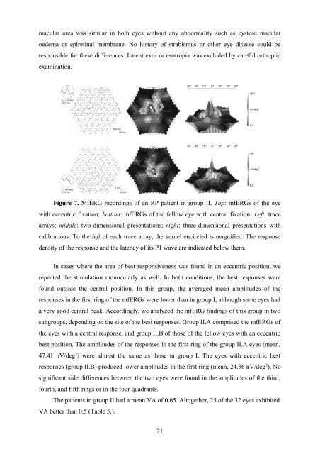 esponses were almost obta