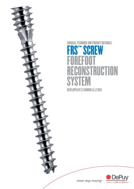 FRSÃ¢Â„Â¢ SCREW FOREFOOT RECONSTRUCTION SYSTEM - Biomet