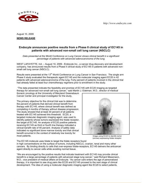 Endocyte announces positive results from a Phase II