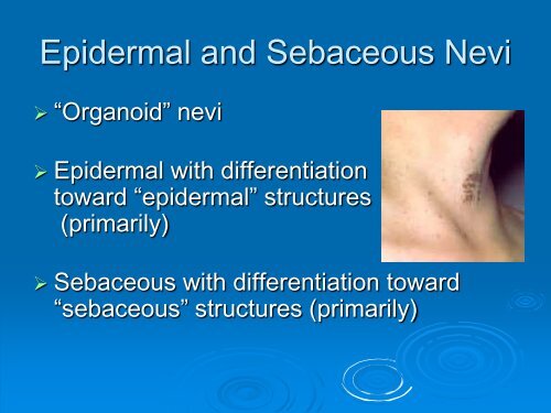 Epidermal