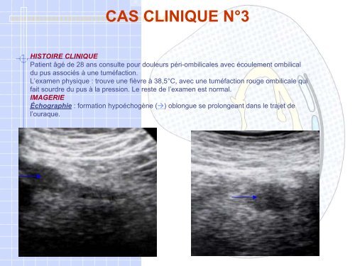 CAS CLINIQUE N°2HISTOIRE