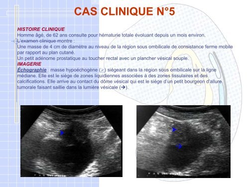 CAS CLINIQUE N°5HISTOIRE