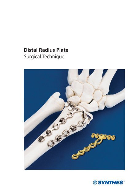 Distal Radius Plate Surgical Technique