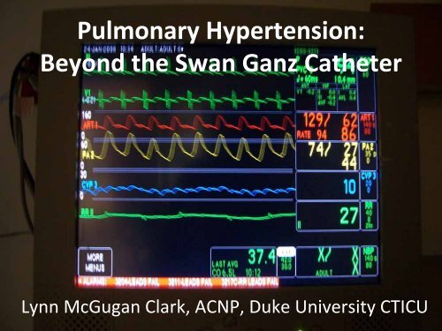 Pulmonary Hypertension: Beyond the Swan Ganz Catheter
