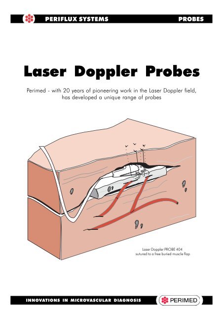 Laser Doppler Probes - Perimed France