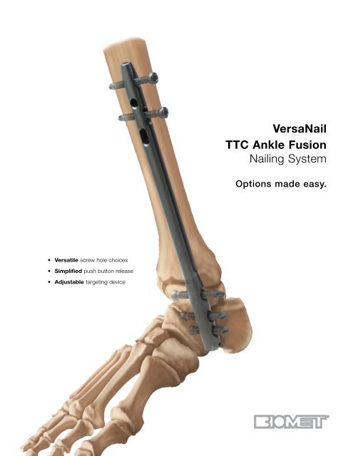 VersaNail TTC Ankle Fusion Nailing System Brochure - Biomet