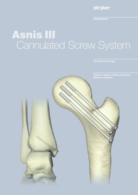 Asnis III Cannulated Screw System - Stryker