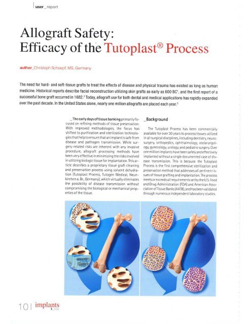 Allograft Safety: Efficacy of the Tutoplast Process - Zimmer Dental