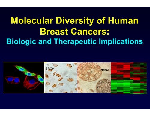 Molecular Diversity of Human Breast Cancers