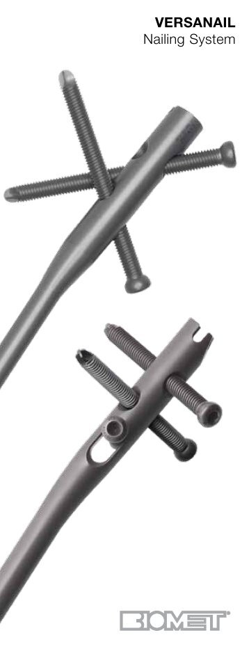 Phoenix™ Antegrade Femoral Nail System Featuring ... - Biomet