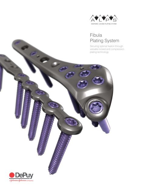Fibula Plating System Surgical Technique - Biomet