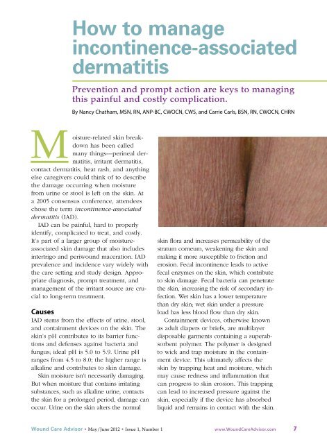 How to manage incontinence-associated dermatitis Prevention and ...