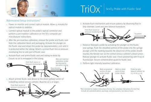 TriOx ScvO2 Tip Card (269 KB) - ICU Medical, Inc.
