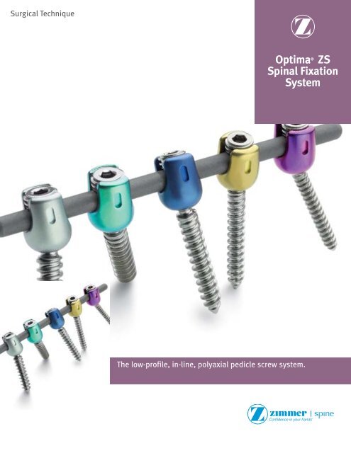 OptimaÂ® ZS Spinal Fixation System