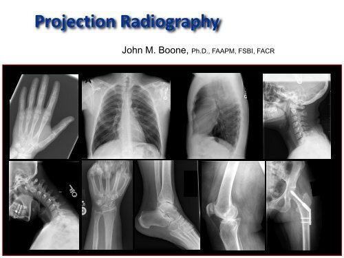 Projection Radiography