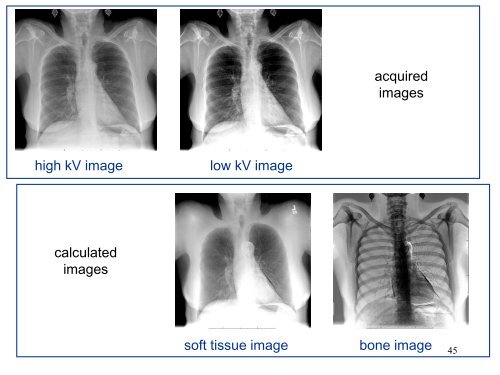 dual energy radiographic
