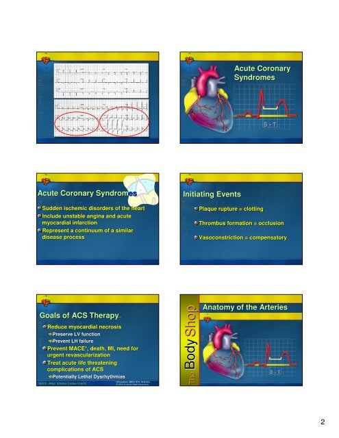 Acute CoronarySyndromesAc