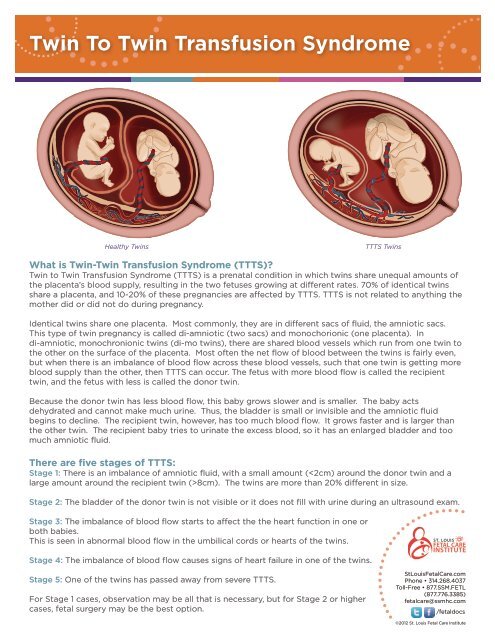 Twin To Twin Transfusion Syndrome