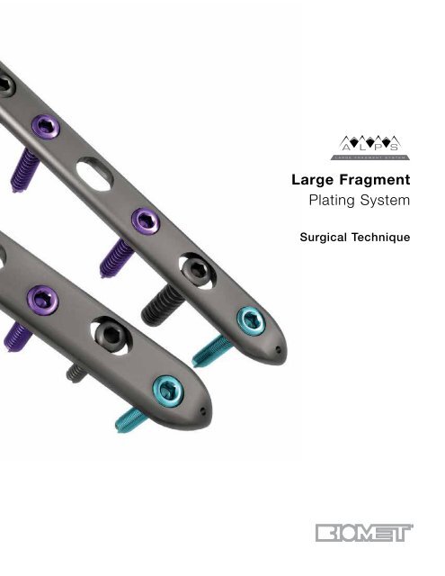 (ALPS) Large Fragment Plating System Surgical Technique - Biomet