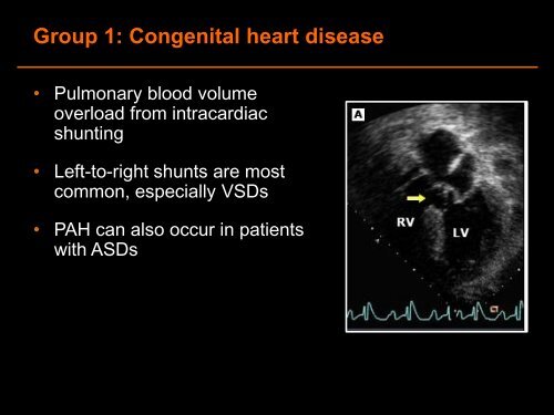 Group 1: Congenital heart