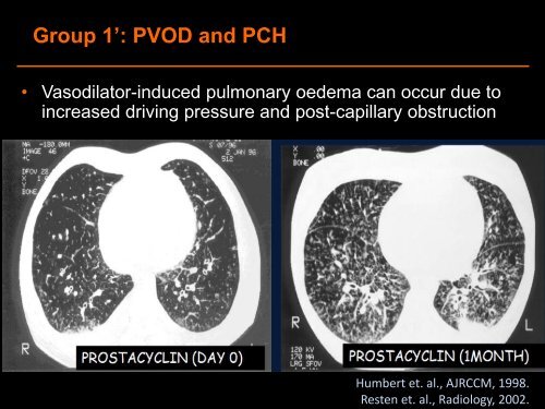 Group 1’: PVOD