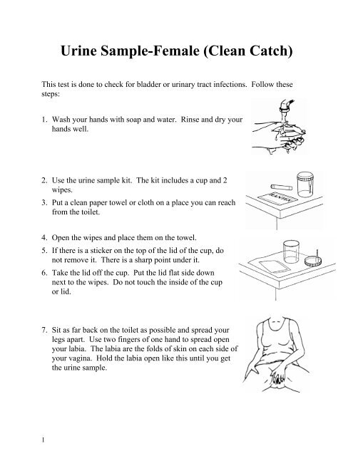 Urine Sample-Female (Clean Catch) - the Exchange