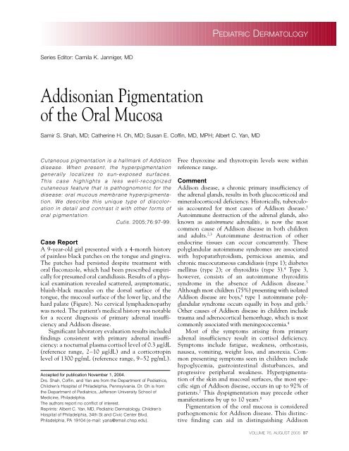 Addisonian Pigmentation of the Oral Mucosa - Cutis