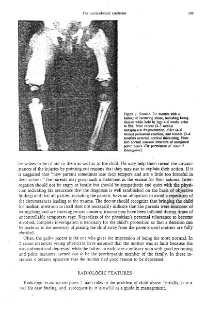 The Battered Child Syndrome - Kempe Children's Center