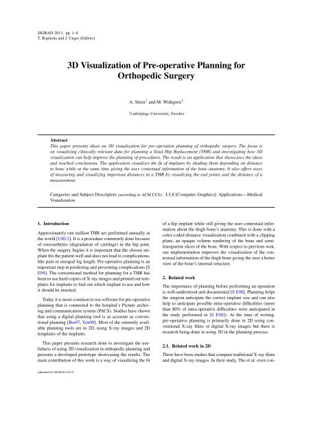 3D Visualization of Pre-operative Planning for Orthopedic Surgery