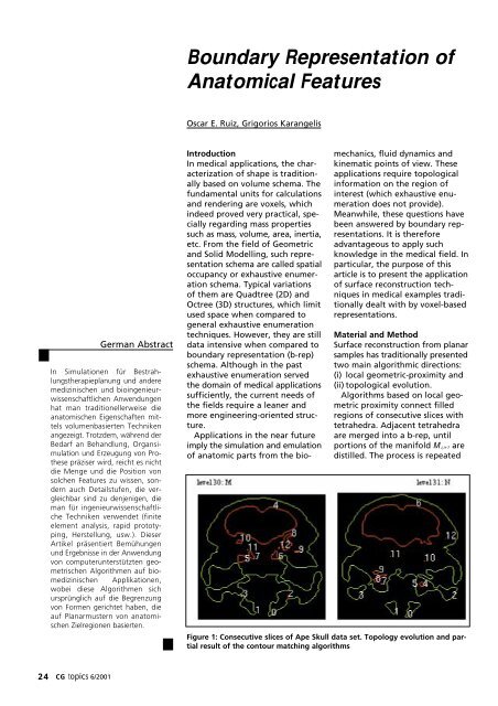 Boundary Representation Of Anatomical Features