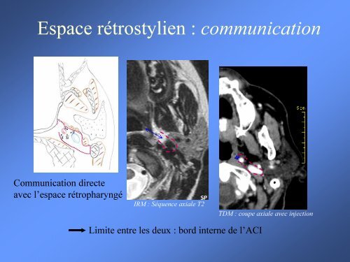 Espace rétrostylien : co