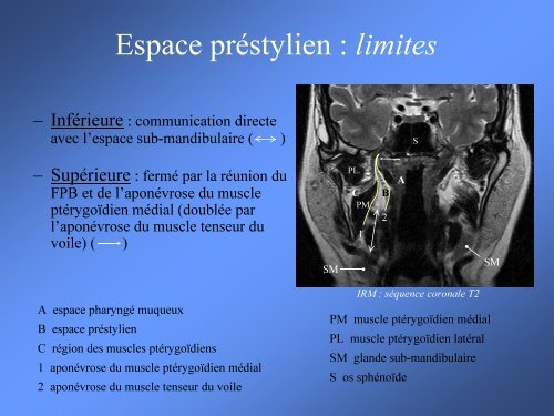Espace préstylien : limi