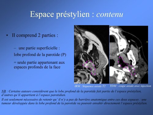 Espace préstylien : cont