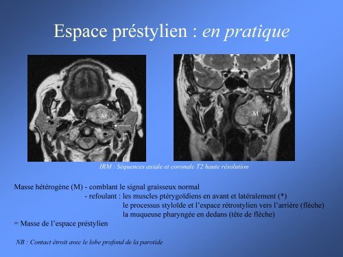 Espace préstylien : en p