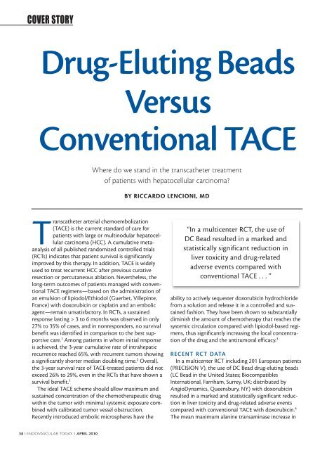 Drug-Eluting Beads Versus Conventional TACE - Biocompatibles