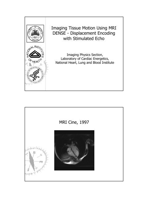 Imaging Tissue Motion Using MRI DENSE - Displacement Encoding ...