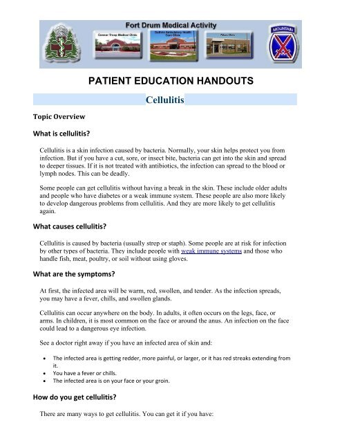 PATIENT EDUCATION HANDOUTS Cellulitis