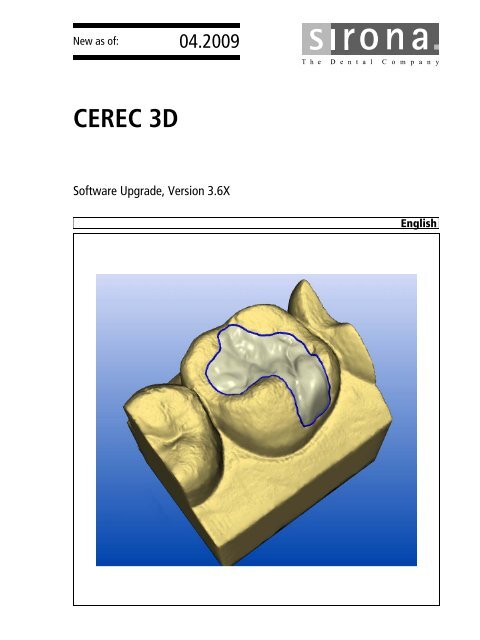 CEREC 3D