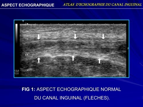ATLAS D’ECHOGRAPHIE DU