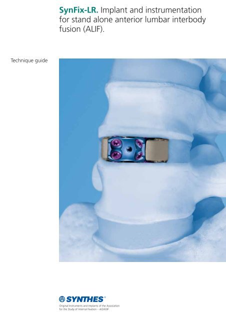 SynFix-LR. Implant and instrumentation for stand alone anterior ...